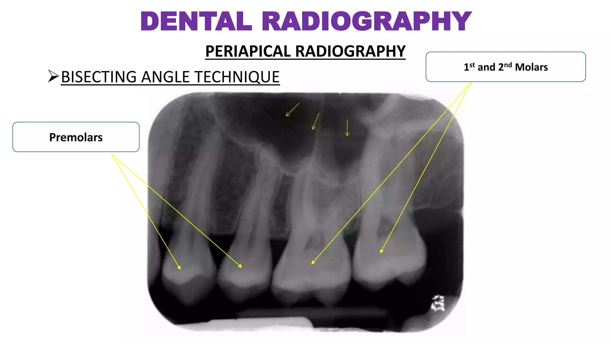 Dental radiography | PPTX