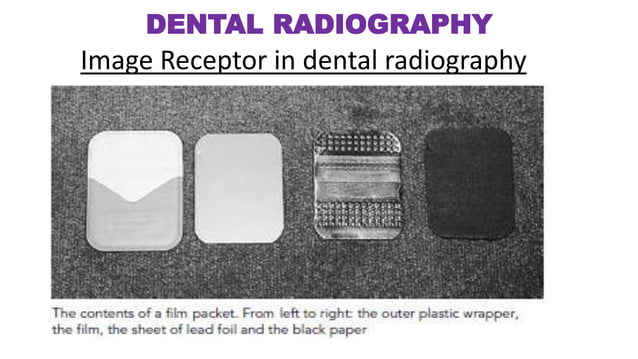 Dental radiography | PPTX | Dental Health | Diseases and Conditions
