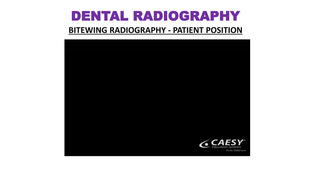 Dental radiography | PPTX | Dental Health | Diseases and Conditions