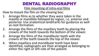Dental radiography | PPTX