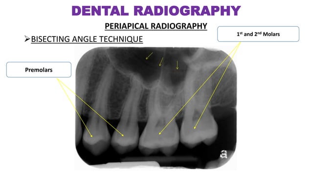 Dental radiography | PPT