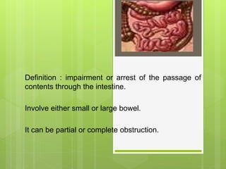Intestinal Obstruction | PPT
