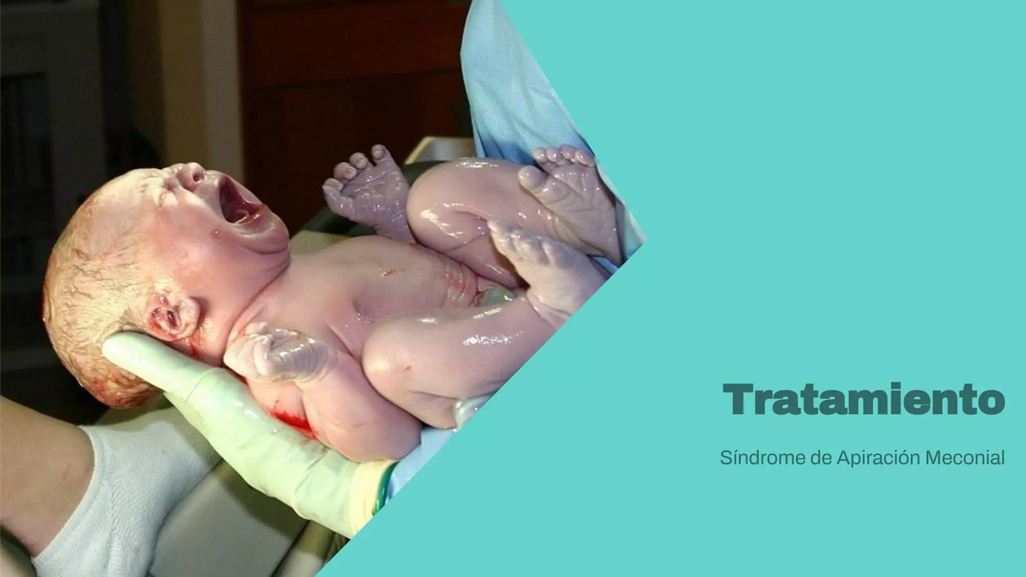 SÍNDROME DE ASPIRACIÓN MECONIAL Y ATELECTASIA | PDF | Pregnancy ...
