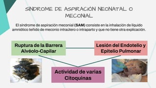 SÍNDROME DE ASPIRACIÓN MECONIAL Y ATELECTASIA | PDF