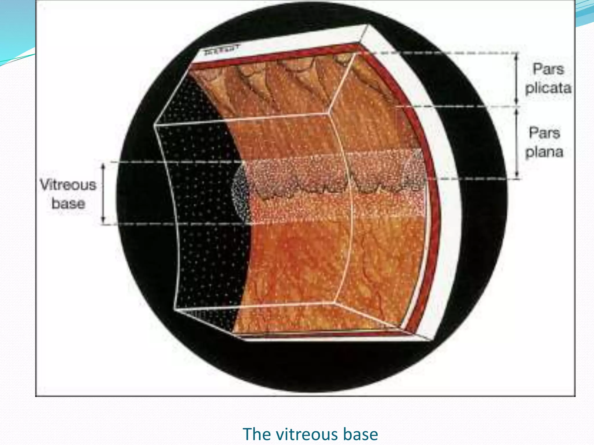 RETINAL DETACHMENT | PPTX