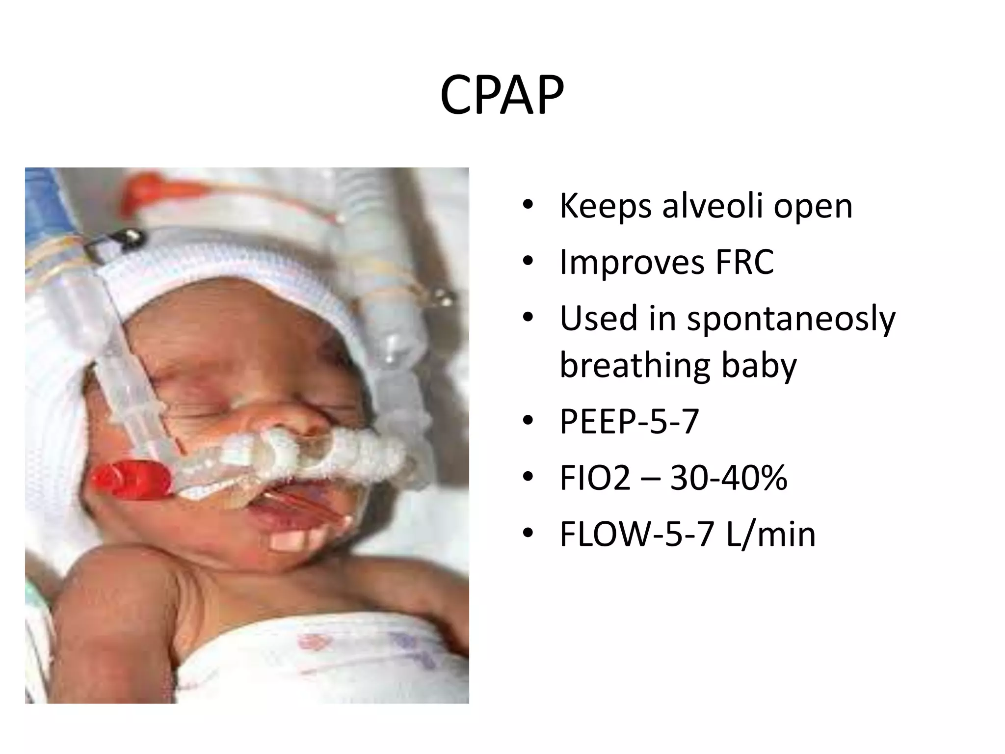 RDS IN NEONATES.pptx