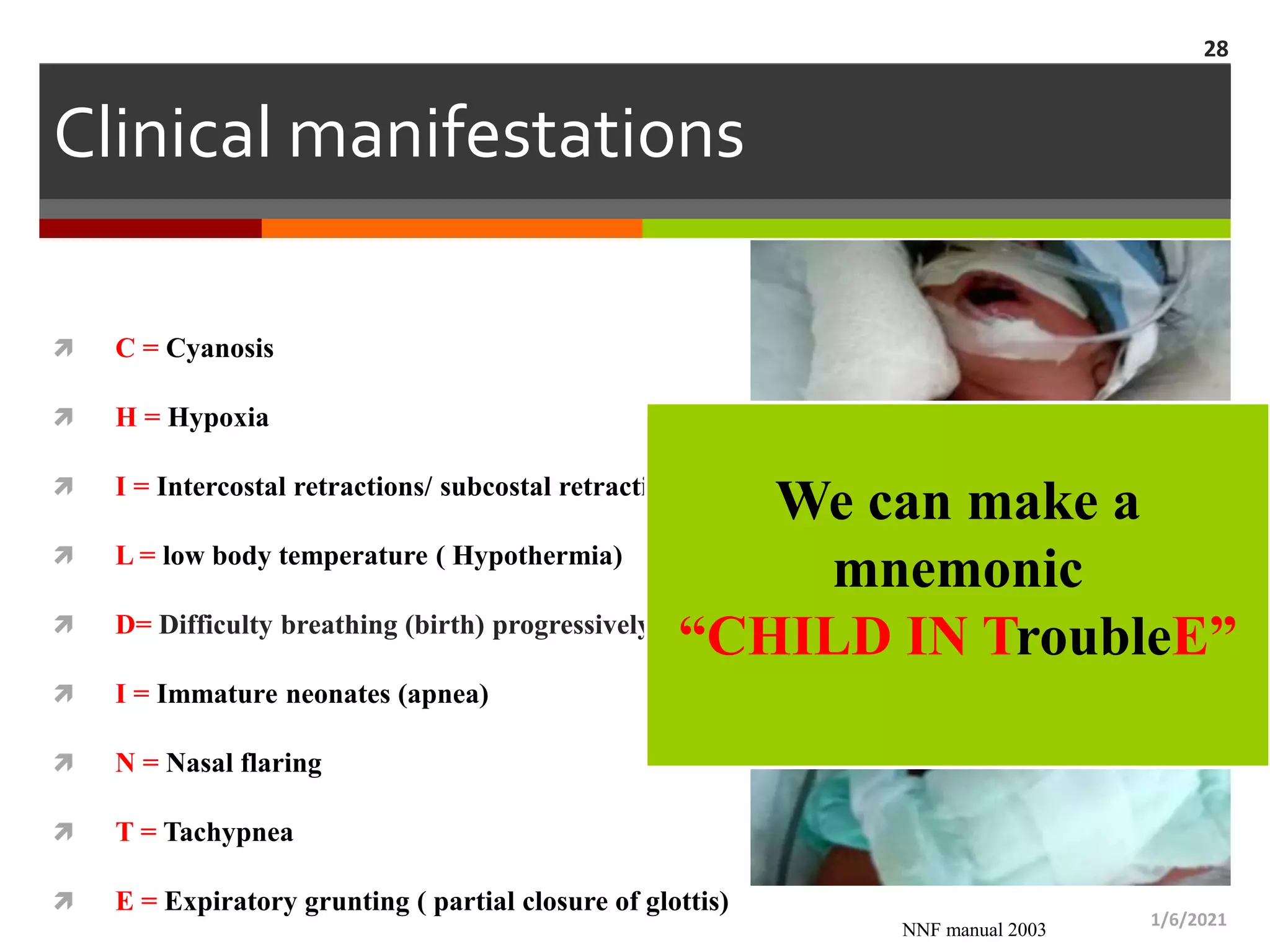 RDS (neonate respiratory distress syndrome) | PPTX