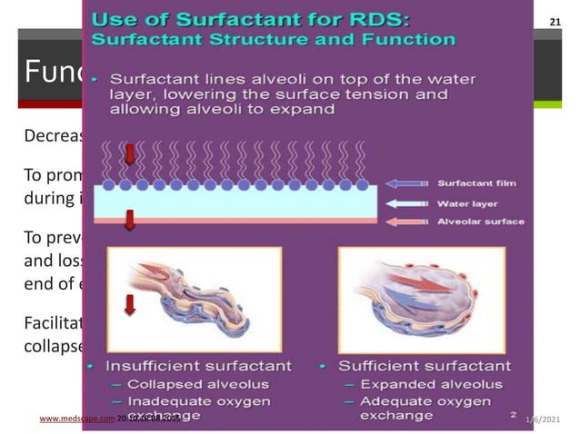 RDS (neonate respiratory distress syndrome) | PPTX