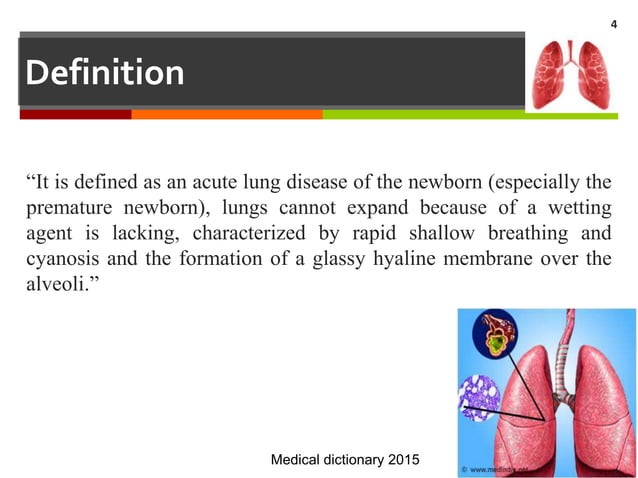 RDS (neonate respiratory distress syndrome) | PPTX