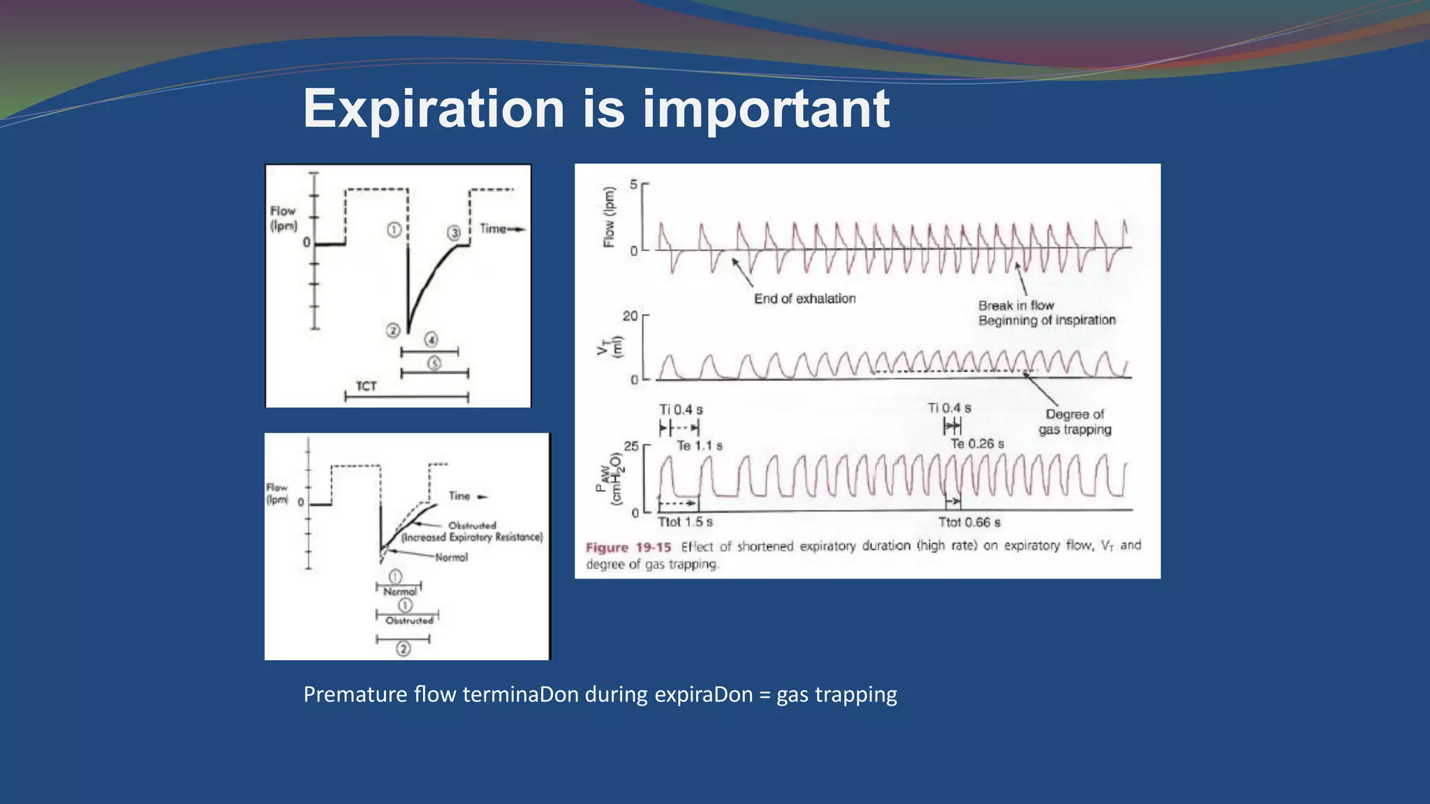 Basic concepts in neonatal ventilation - Safe ventilation of neonate ...