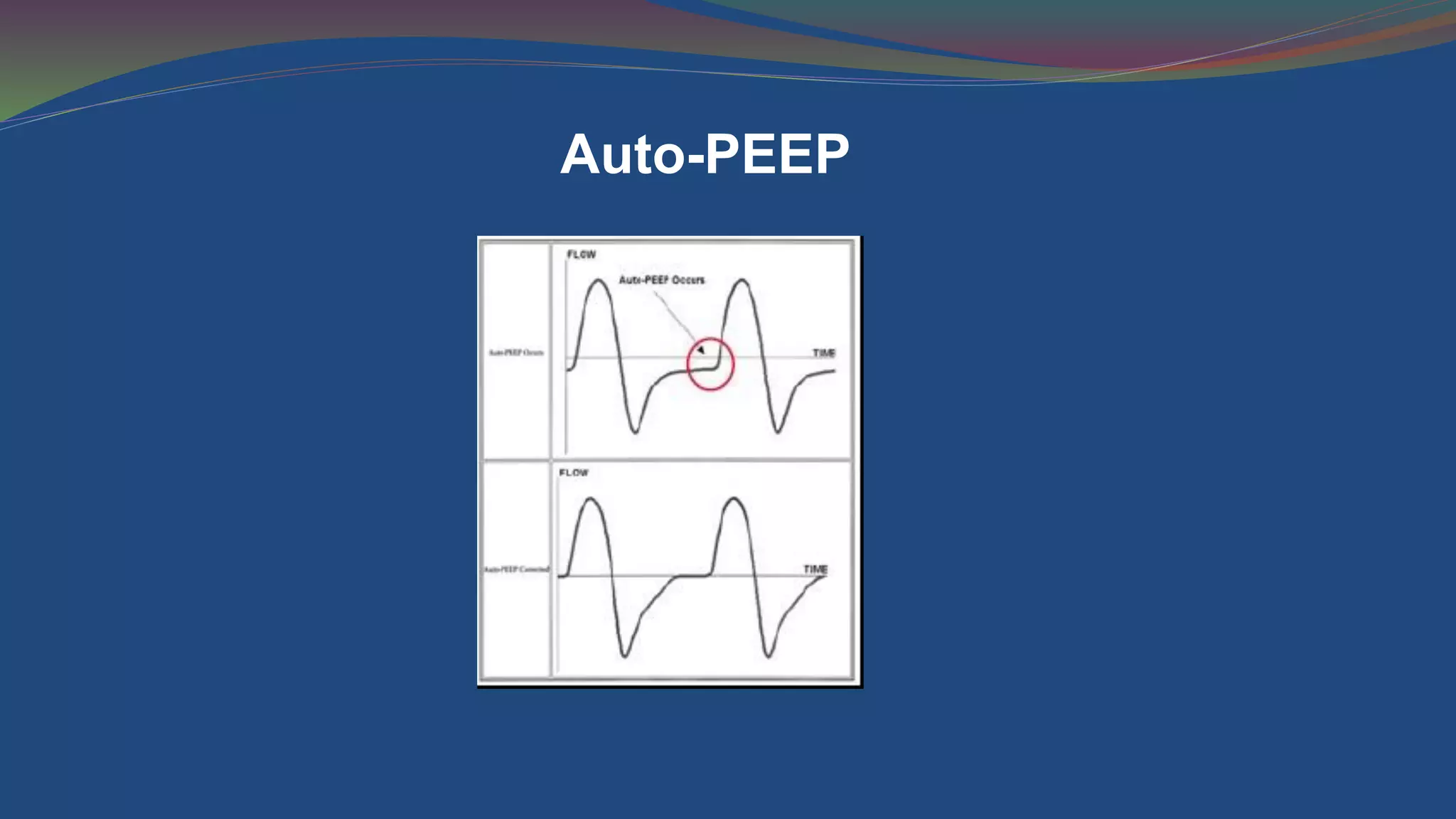 Basic concepts in neonatal ventilation - Safe ventilation of neonate ...