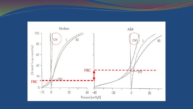 Basic concepts in neonatal ventilation - Safe ventilation of neonate ...