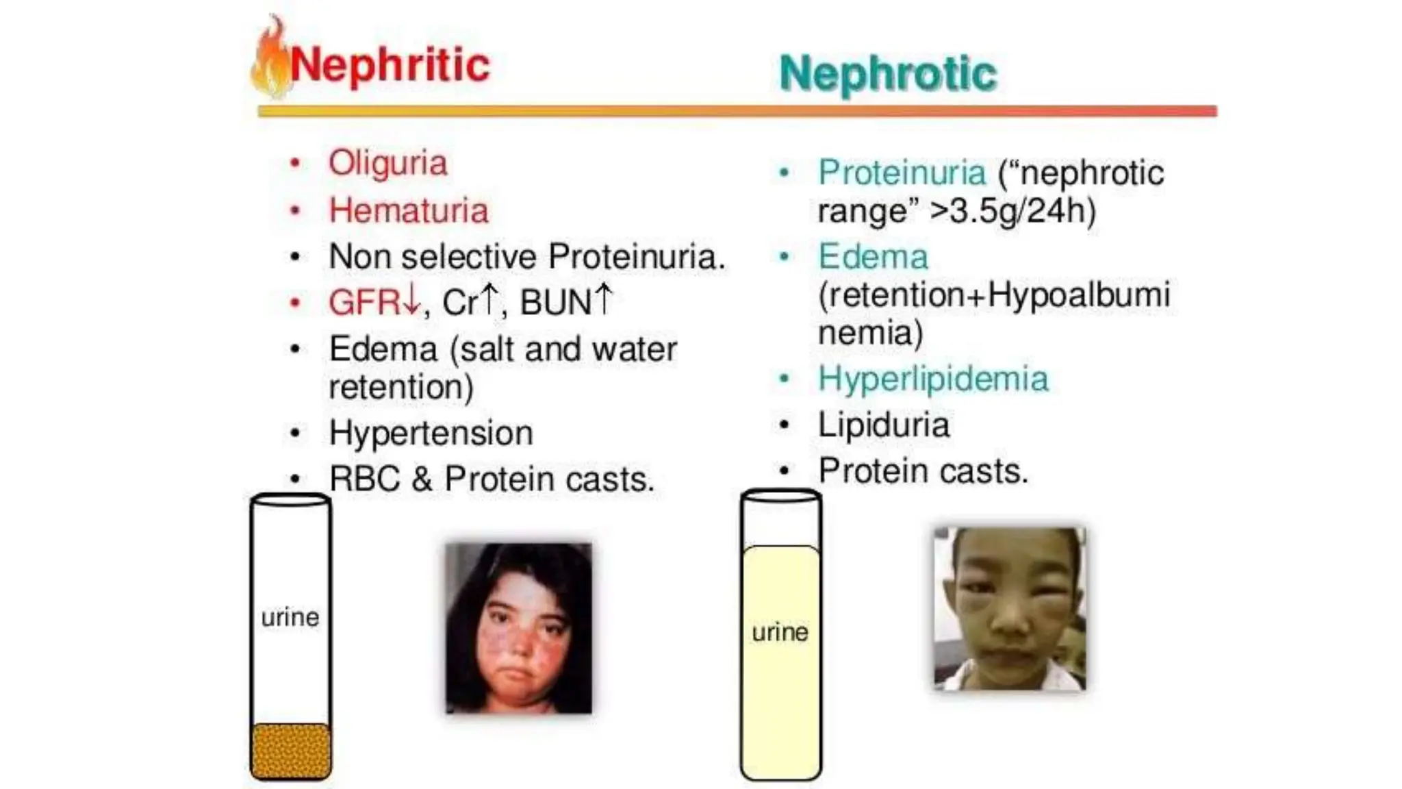 Nephritic syndrome - Medicine - RDT | PPTX