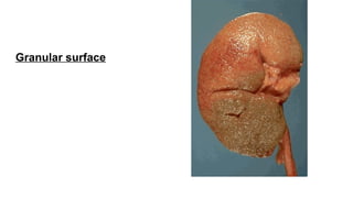 Renal vascular diseases - Pathology - BSc. RDT | PPTX