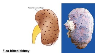 Renal vascular diseases - Pathology - BSc. RDT | PPTX