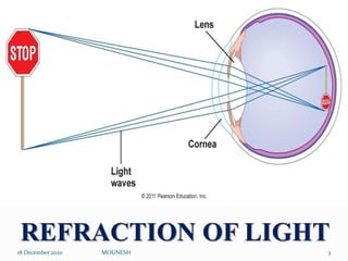 Refractive Errors | PPTX