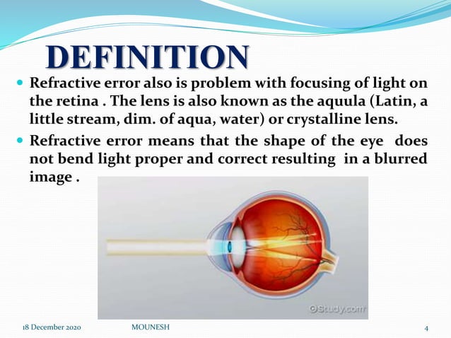 Refractive Errors | PPT | Free Download