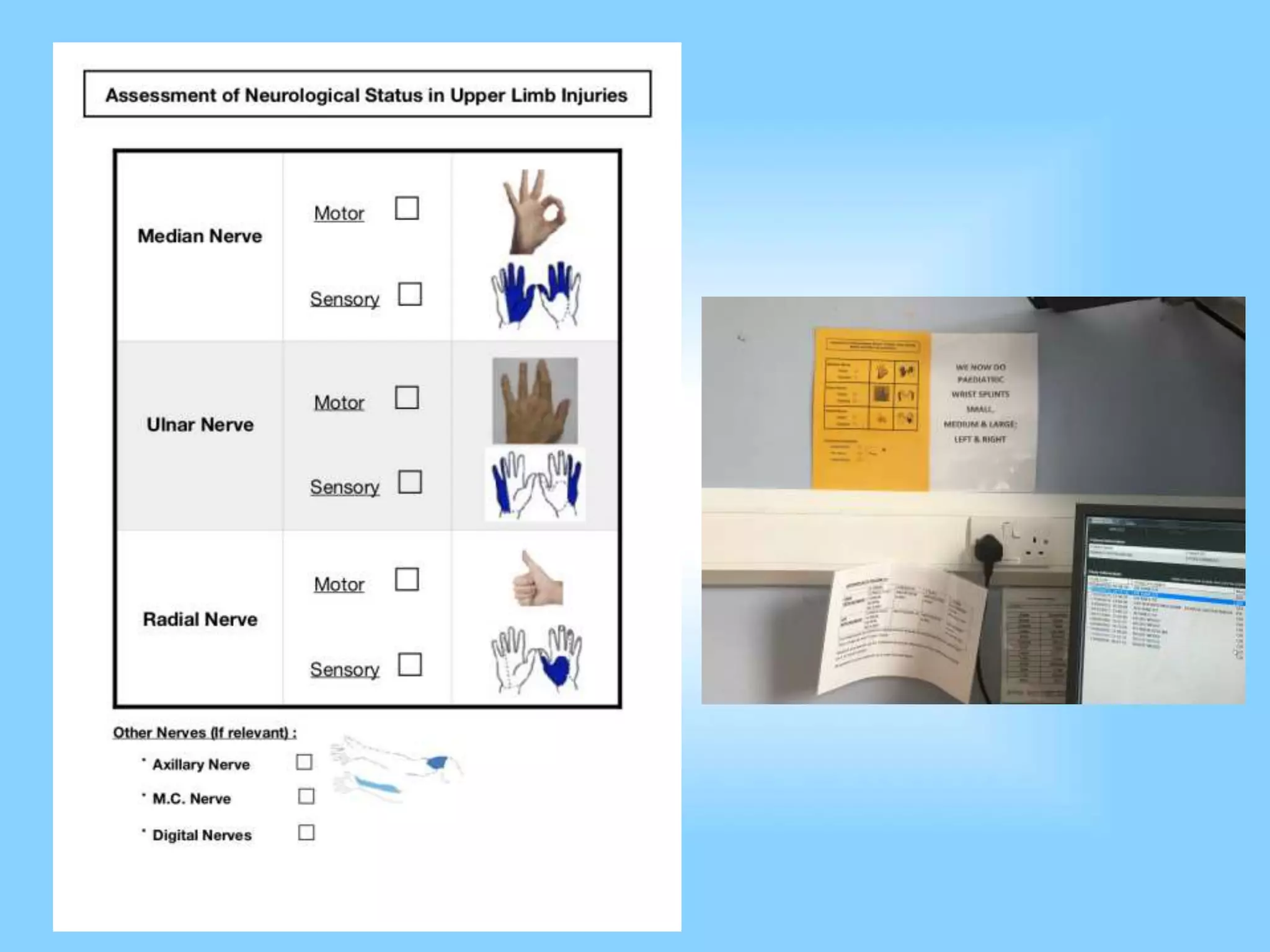 Neurological examination in upper limb trauma audit | PPTX