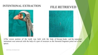 Re-implantationgoodforendodonticsss.pptx