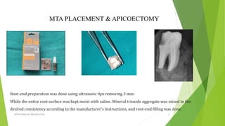 Re-implantationgoodforendodonticsss.pptx