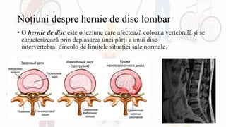 Reabilitarea în hernie de disc lombar.pptx