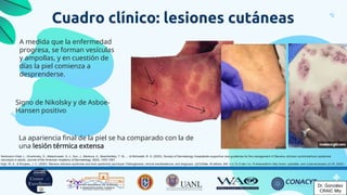 Sesión Académica del CRAIC "Reacciones adversas cutáneas graves" | PDF