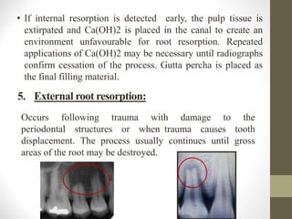 Reaction of teeth to trauma | PPT