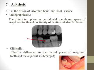 Reaction of teeth to trauma | PPT