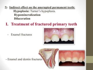 Reaction of teeth to trauma | PPT