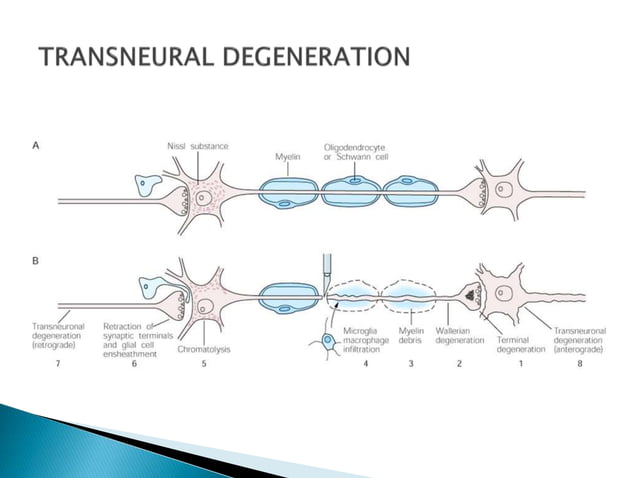 Reactions of neurons to injury | PPT