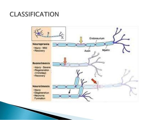 Reactions of neurons to injury