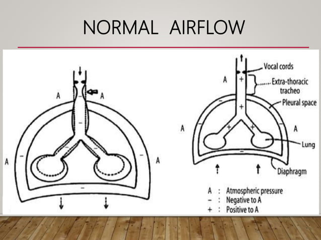 Reactive airway obstruction in children detection management_2018_pmm | PPT