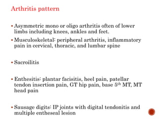 Reactive arthritis | PPT