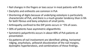 REACTIVE ARTHRITIS.pptx