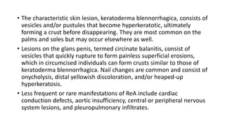 REACTIVE ARTHRITIS.pptx