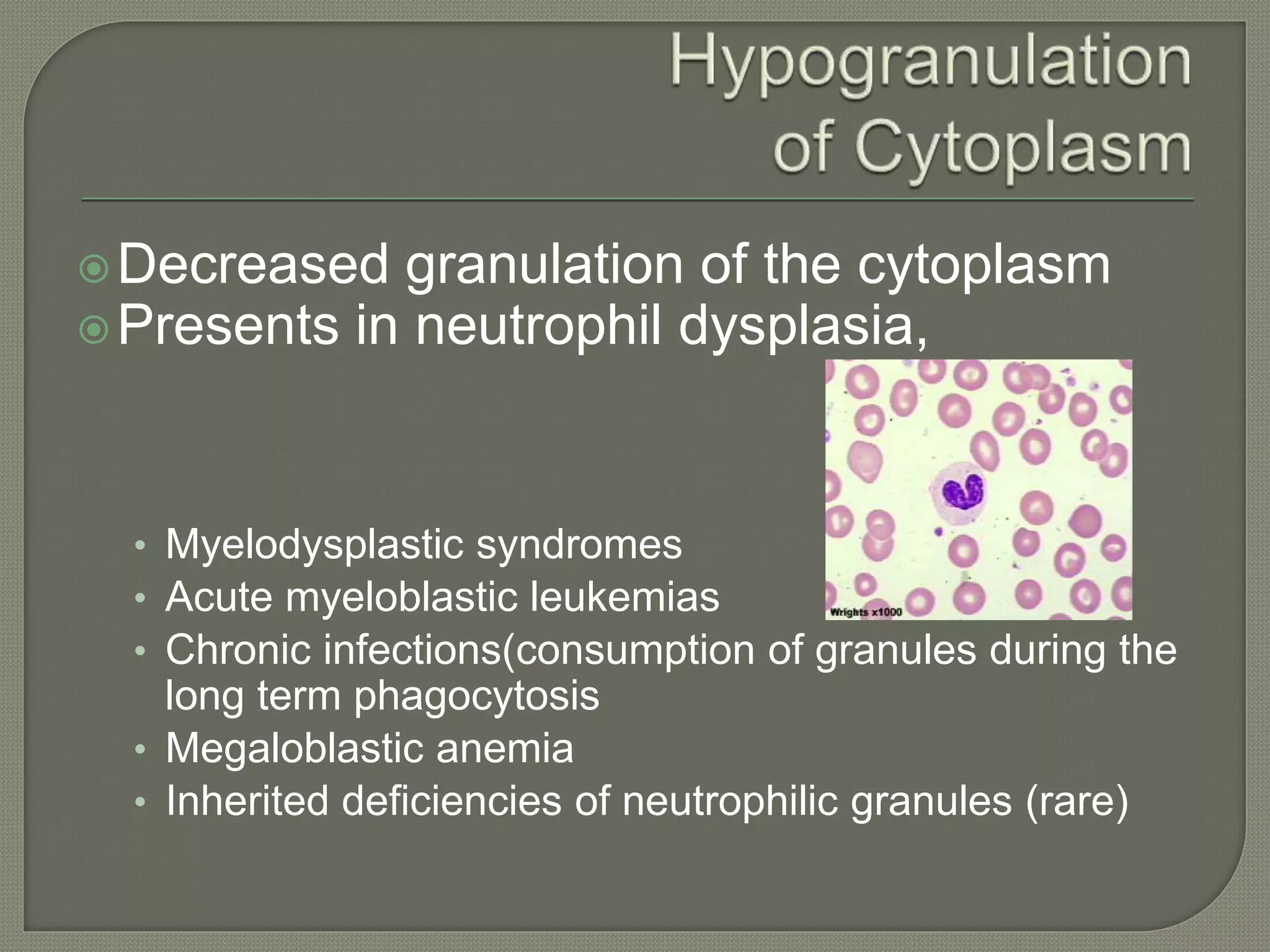 Reactive Atypical Abnormal Morphology of neutrophils | PPTX