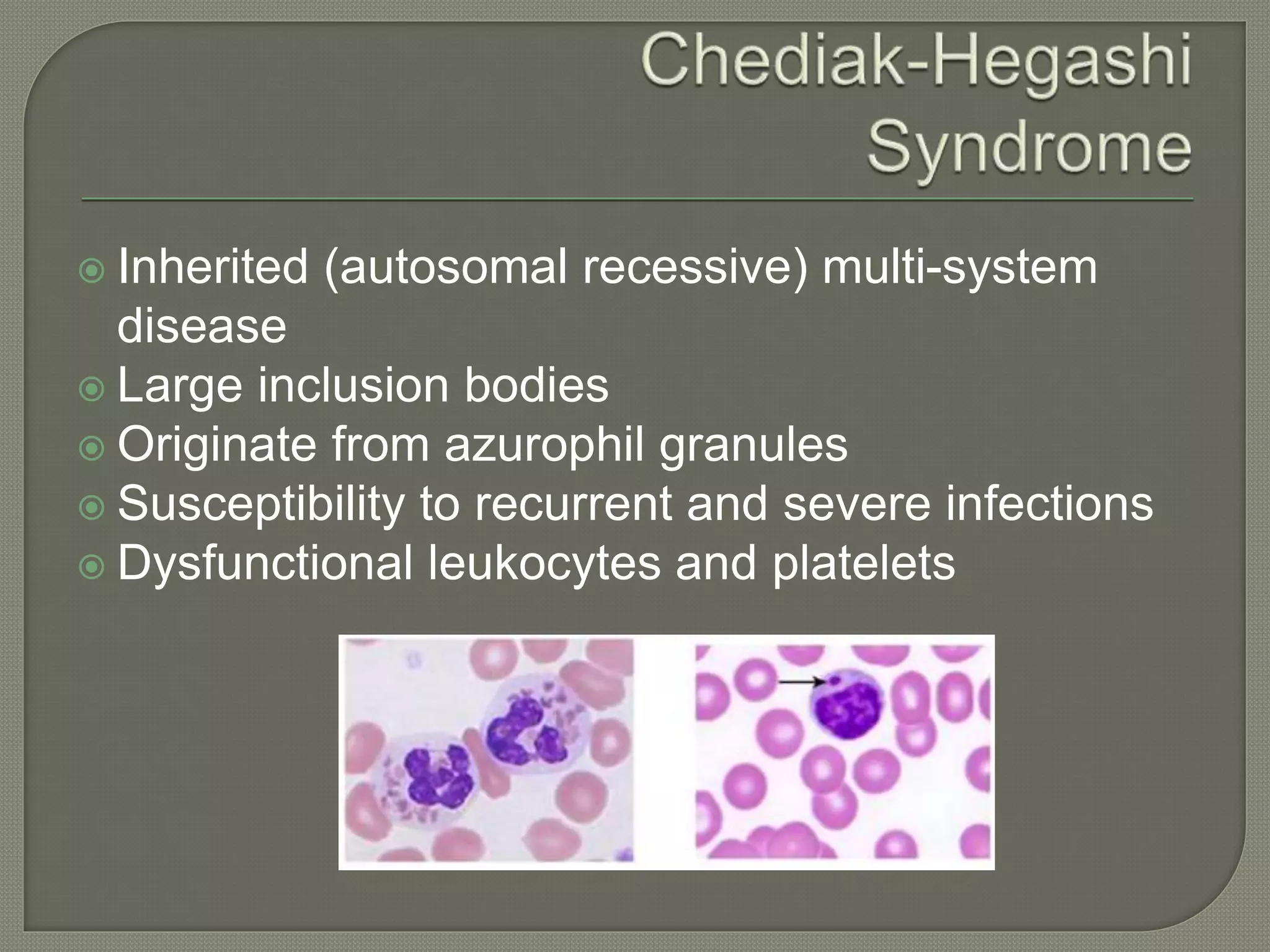 Reactive Atypical Abnormal Morphology of neutrophils | PPTX