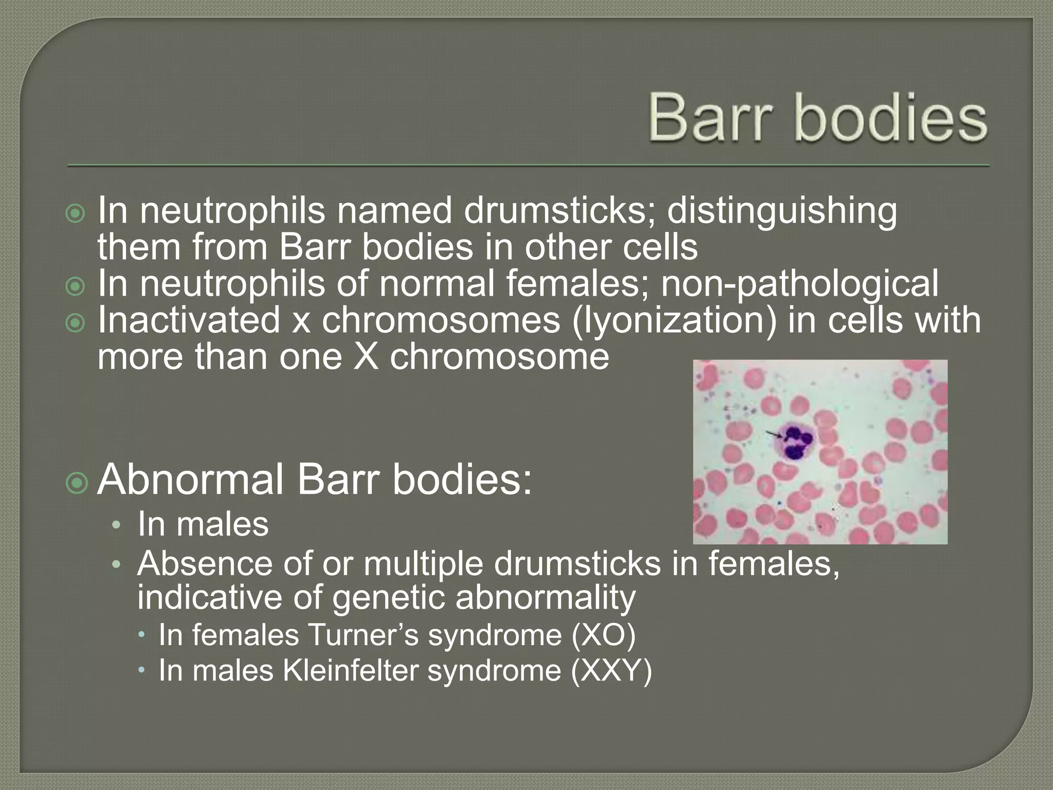 Reactive Atypical Abnormal Morphology of neutrophils | PPTX
