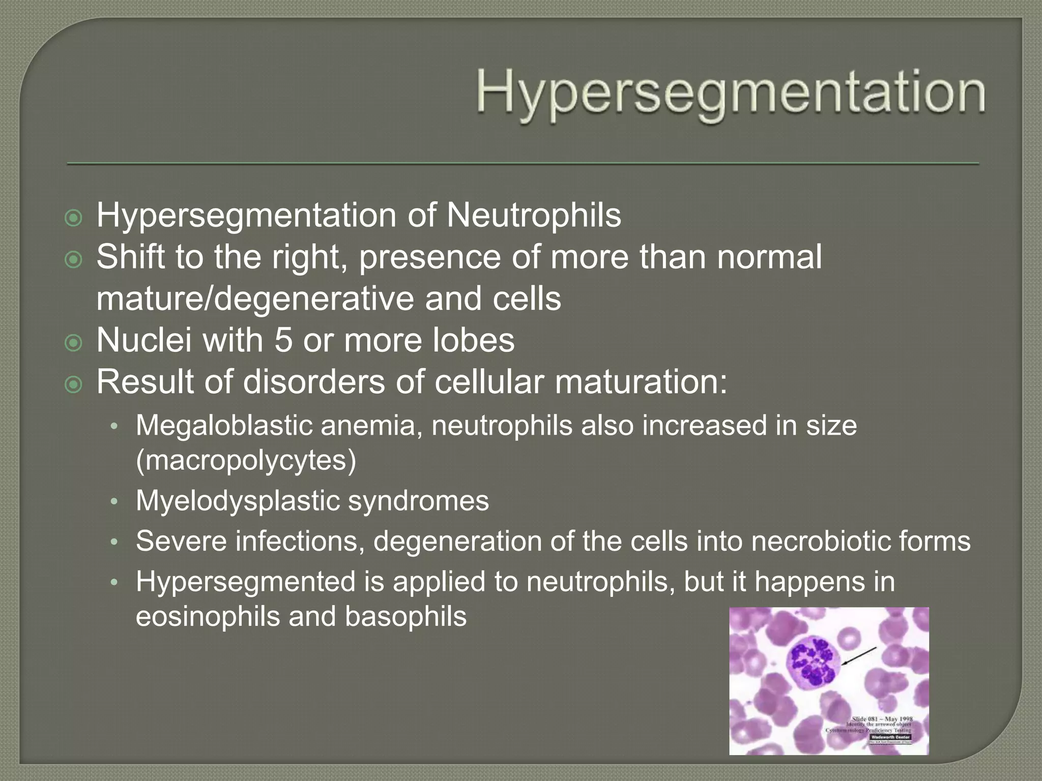 Reactive Atypical Abnormal Morphology of neutrophils | PPTX