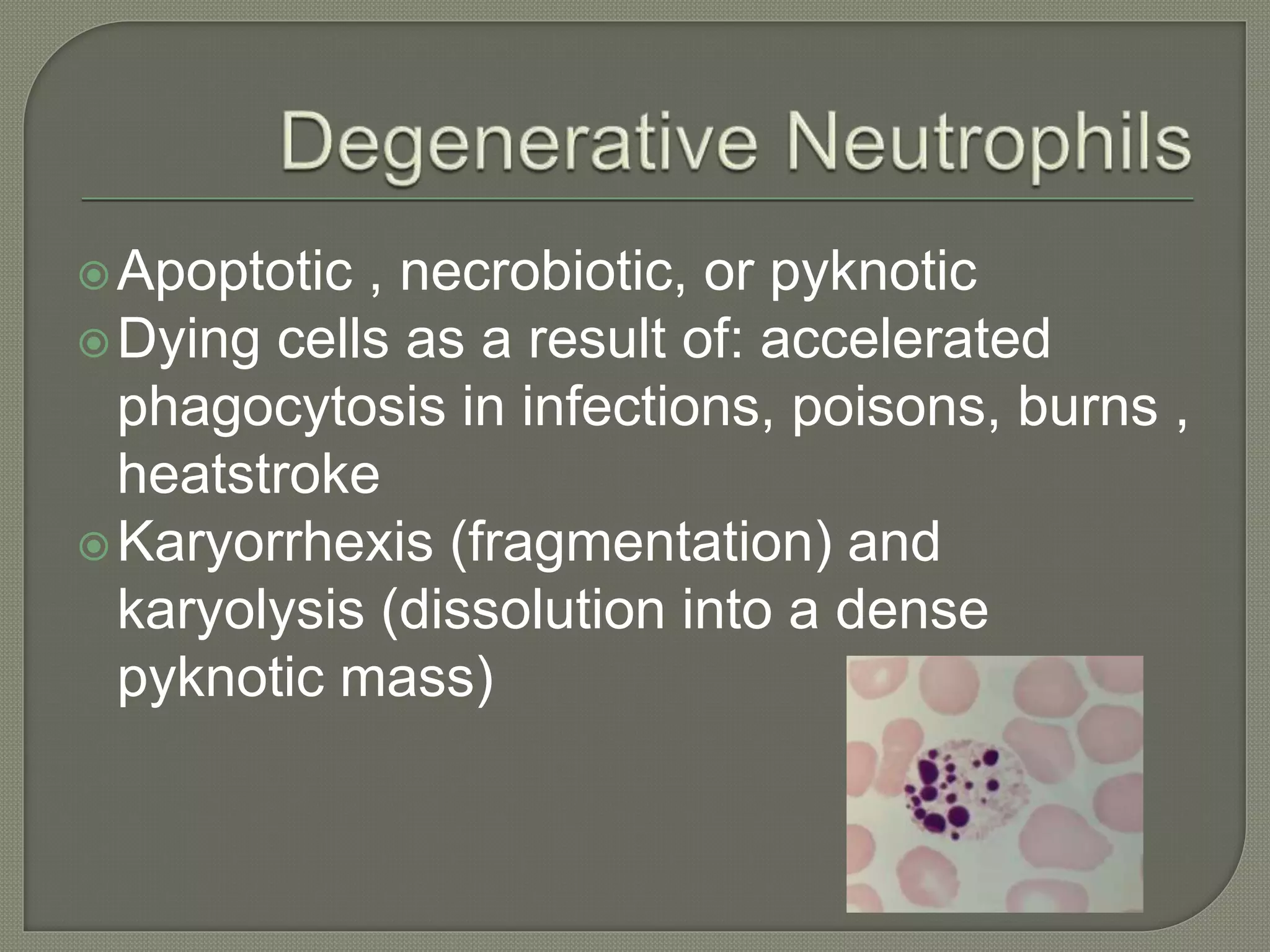 Reactive Atypical Abnormal Morphology of neutrophils | PPTX