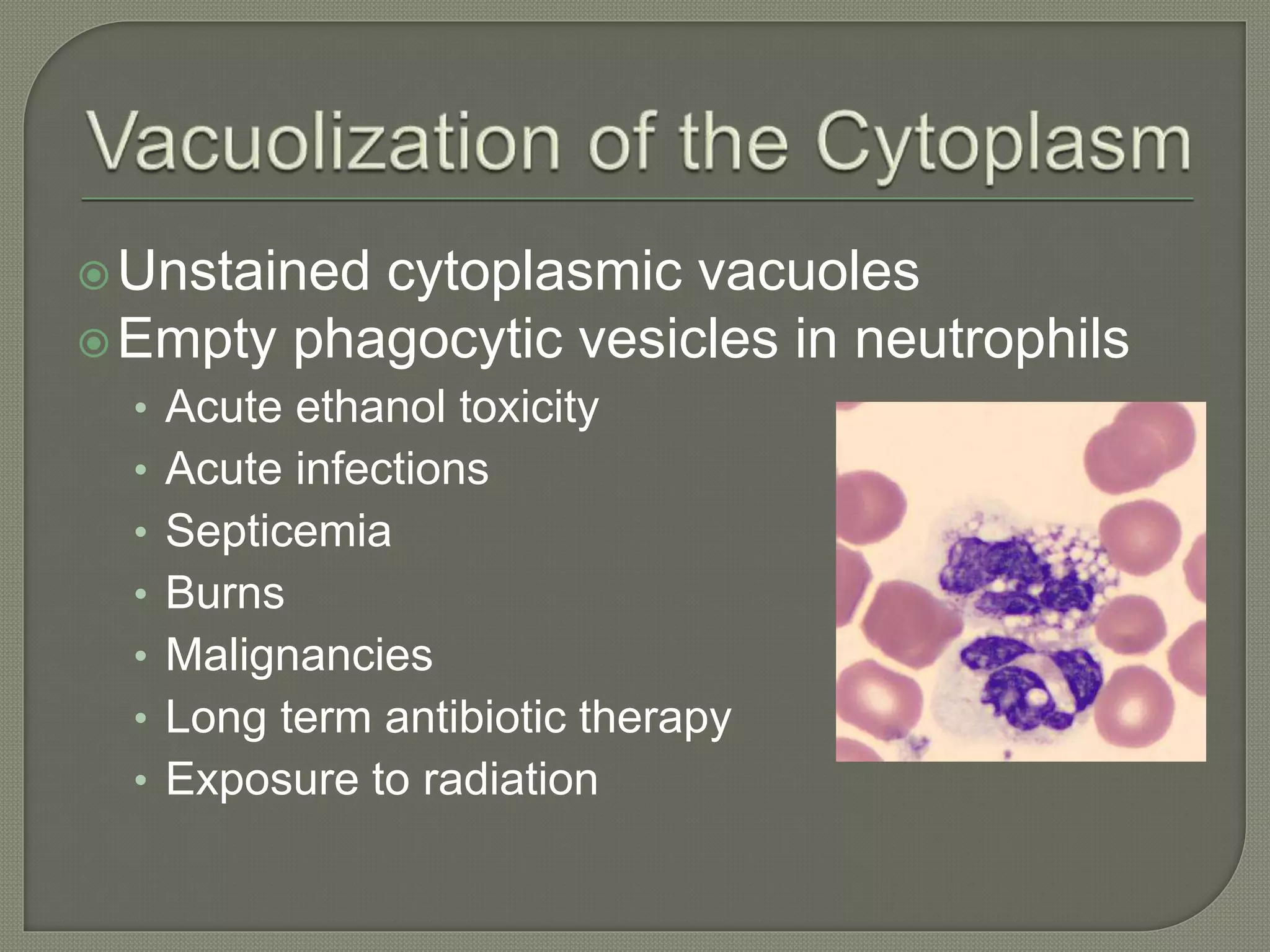 Reactive Atypical Abnormal Morphology of neutrophils | PPTX