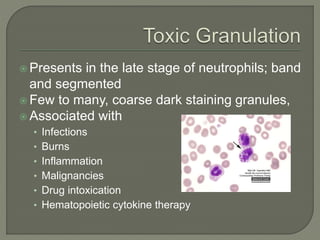 Segmented Neutrophil With Toxic Granulation