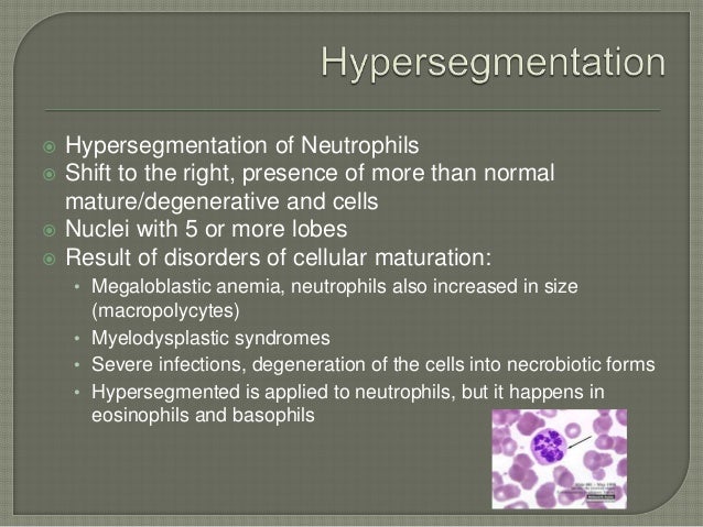 Reactive Atypical Abnormal Morphology of neutrophils