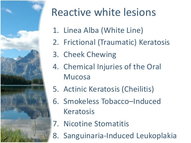 Inflammatory And Reactive Lesions Of The Oral Mucosa