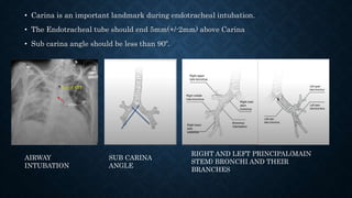 Reading chest-x-rays | PPT