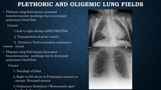 Reading chest-x-rays | PPT