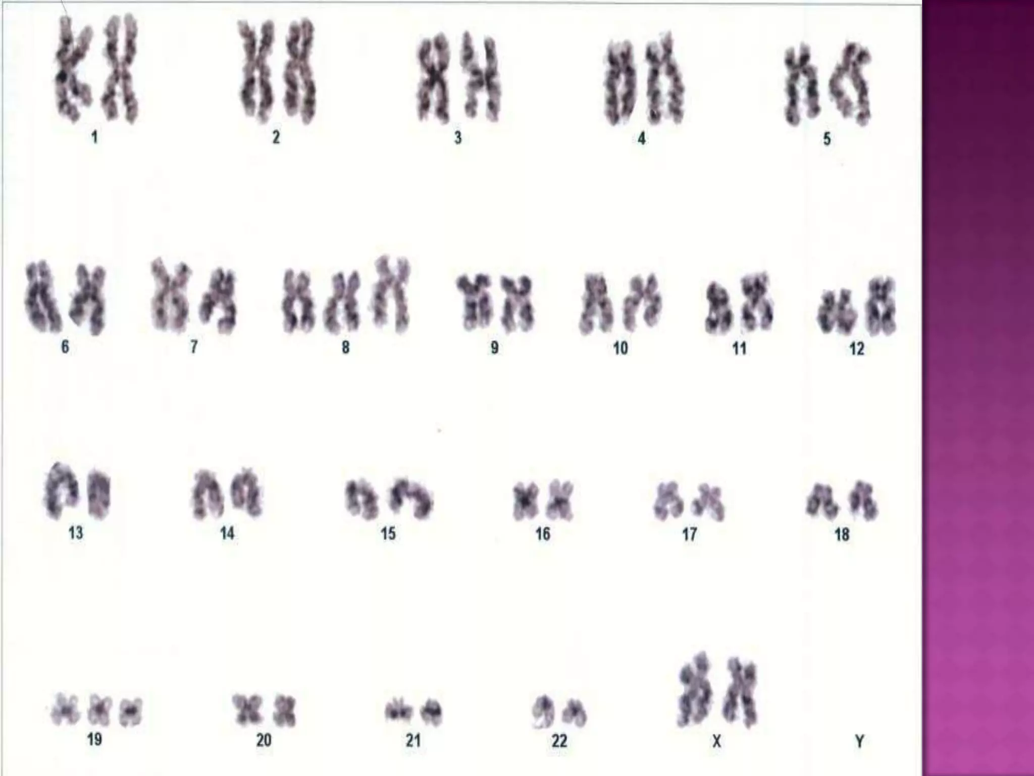Karyotypes and Karyotyping | PPTX
