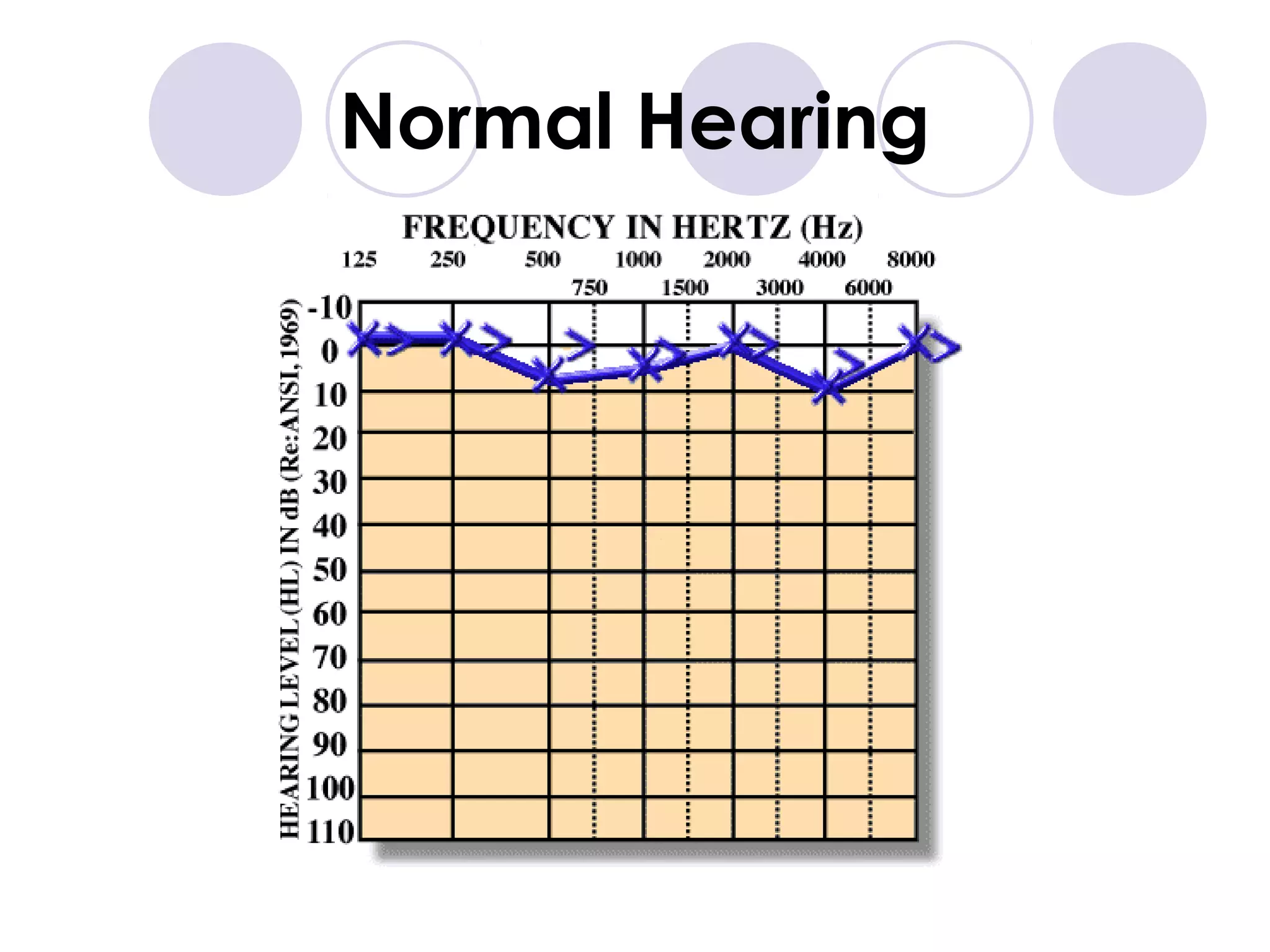 Reading an audiogram | PPT
