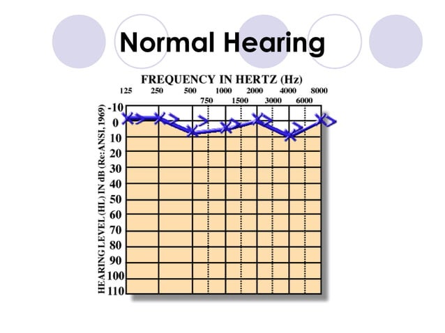 Reading an audiogram | PPT | Digital Audio | Computer Software and ...