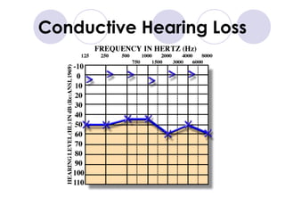 Reading an audiogram | PPT
